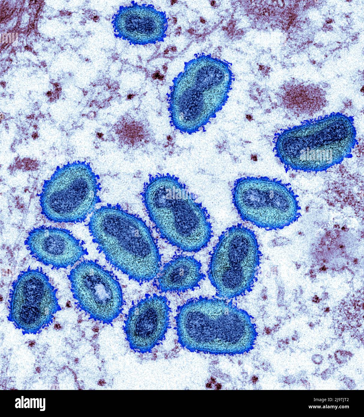 Monkeypox virus particles, TEM Stock Photo - Alamy
