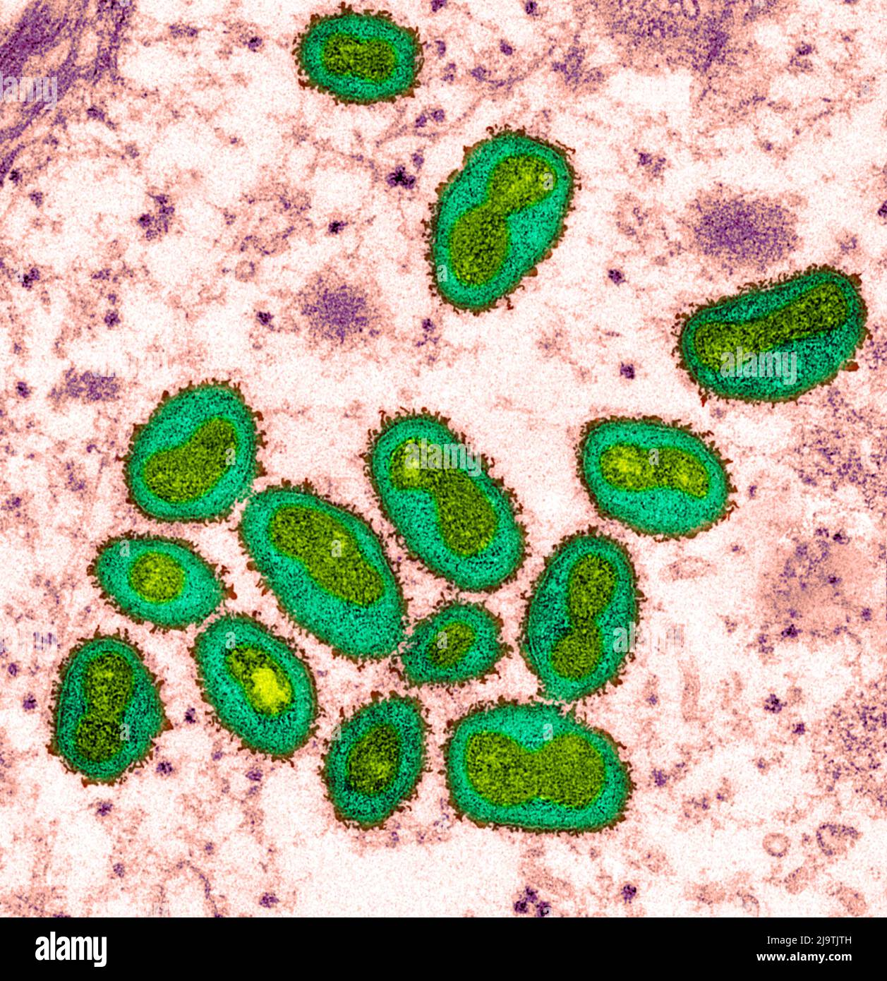 Monkeypox virus particles, TEM Stock Photo - Alamy