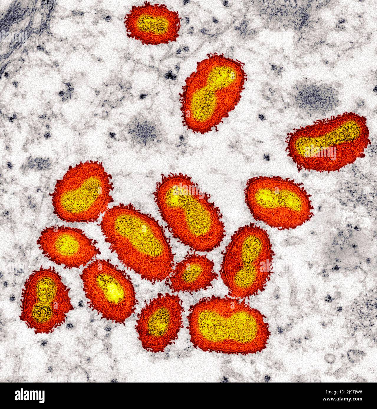 Monkeypox virus particles, TEM Stock Photo - Alamy