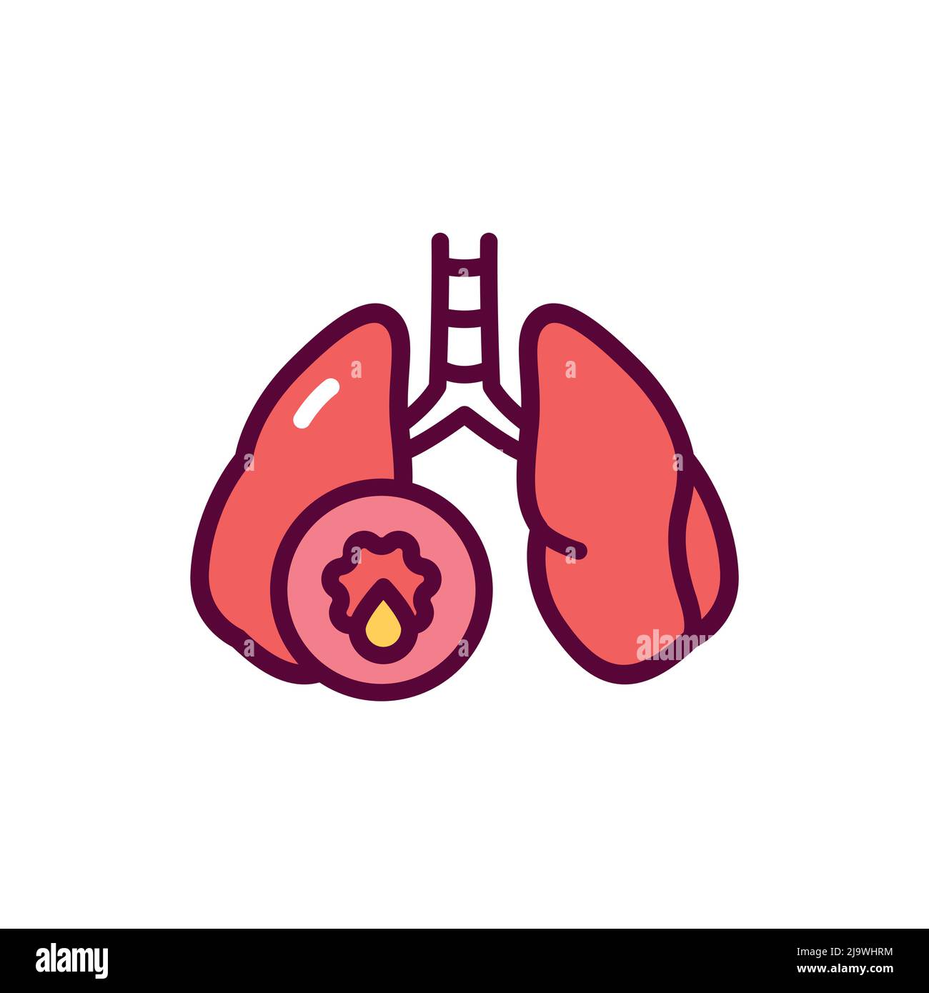 Pulmonary disease astma color line icon. Isolated vector element ...