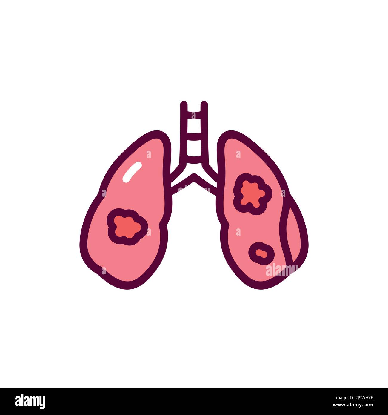 Pulmonary disease cancer color line icon. Isolated vector element ...