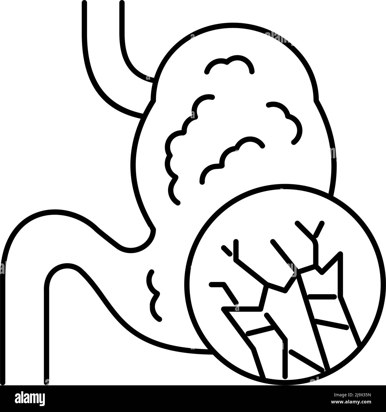 abdominal swelling mesothelioma line icon vector illustration Stock ...