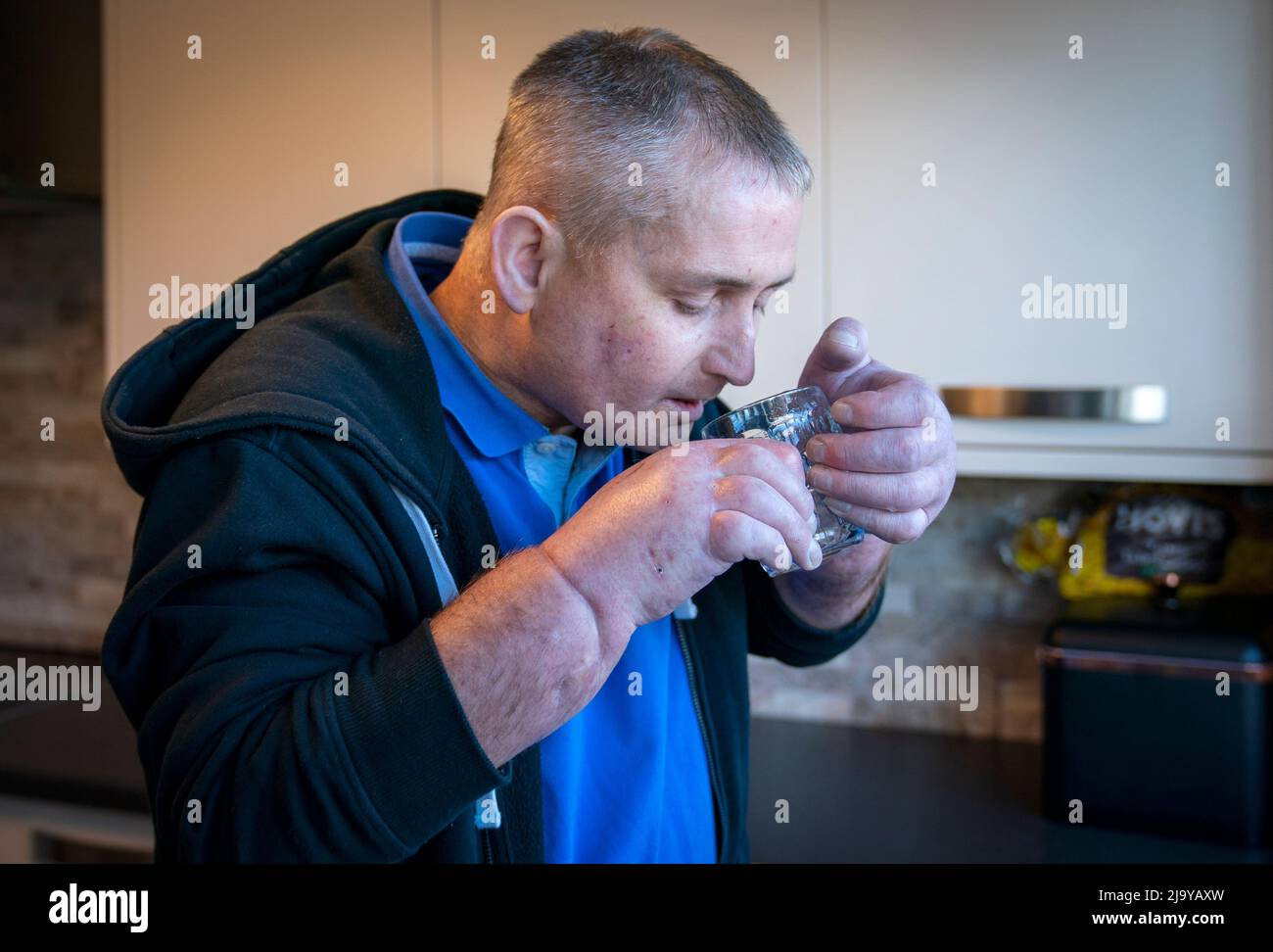 Steven Gallagher, from Dreghorn, Ayrshire, drinks a glass of water he ...