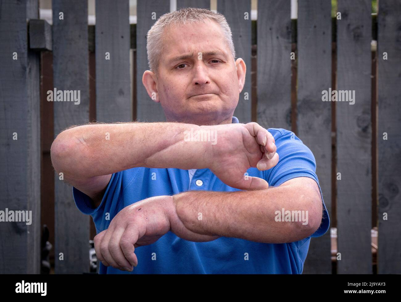 Steven Gallagher, from Dreghorn, Ayrshire, is the first person in the ...