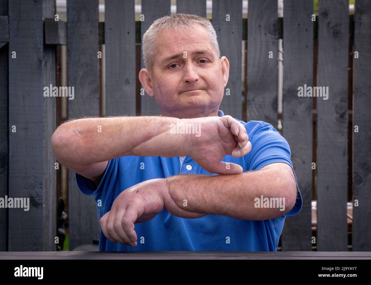 Steven Gallagher, from Dreghorn, Ayrshire, is the first person in the ...