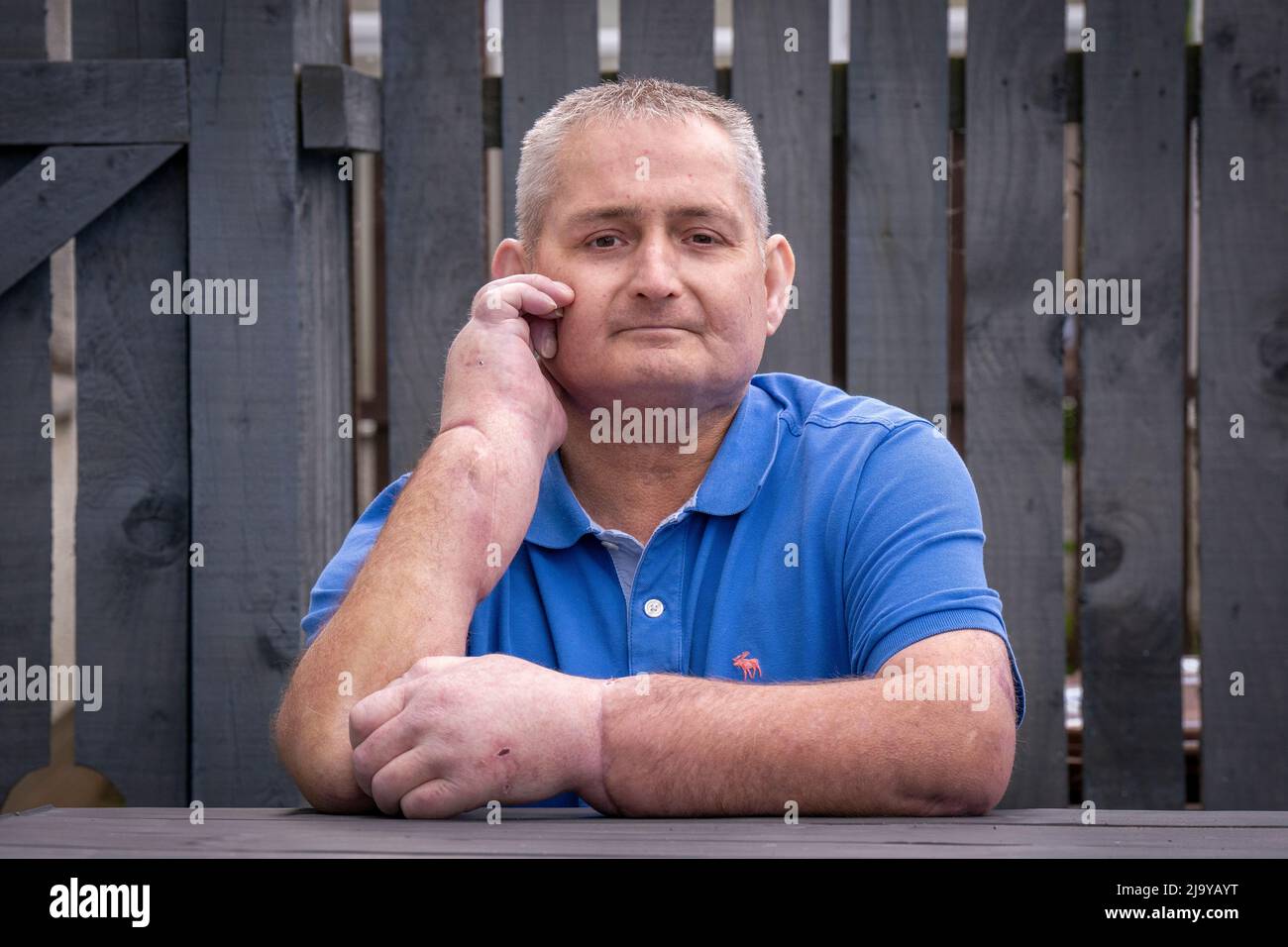 Steven Gallagher, from Dreghorn, Ayrshire, is the first person in the ...