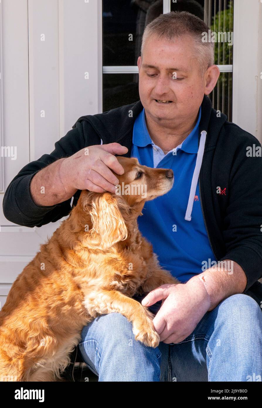 Scleroderma hands hi-res stock photography and images - Alamy