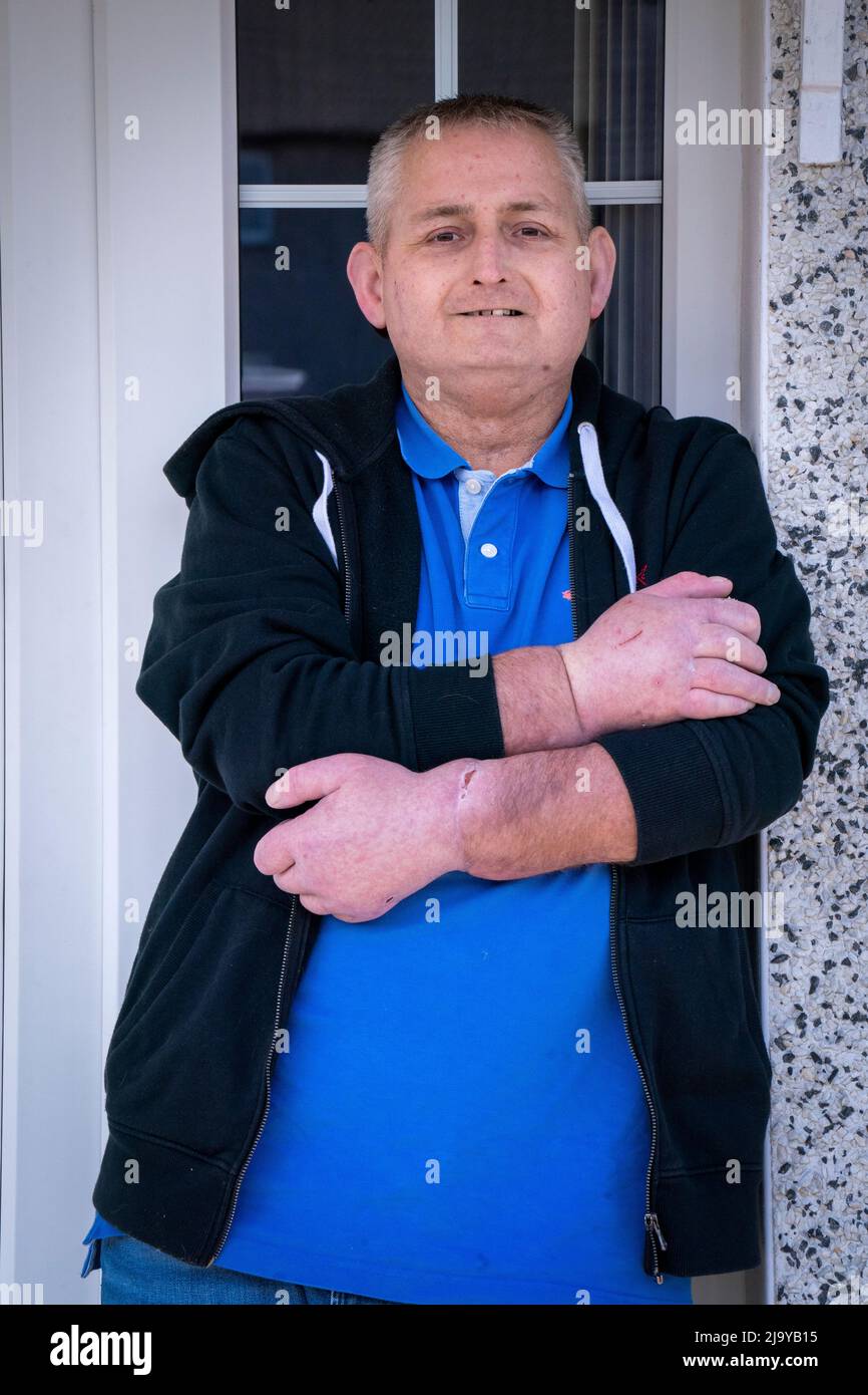 Steven Gallagher, from Dreghorn, Ayrshire, is the first person in the ...