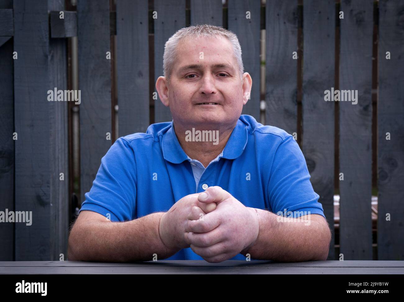 Steven Gallagher, from Dreghorn, Ayrshire, is the first person in the ...