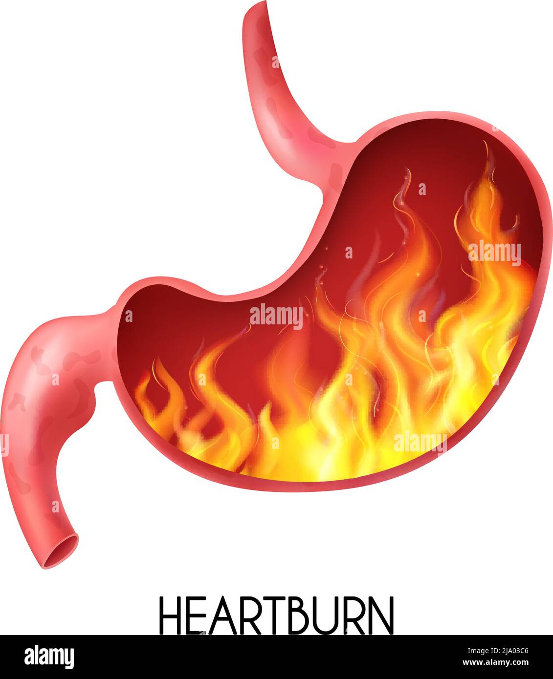 Realistic human internal organ stomach with heartburn on white ...