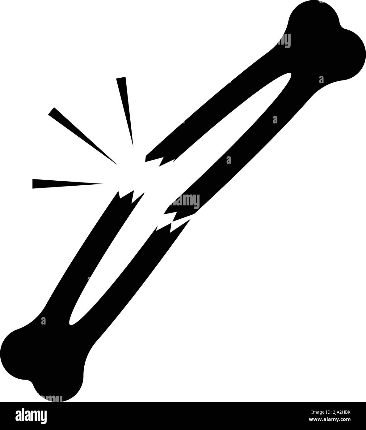 Simple fracture hi-res stock photography and images - Alamy