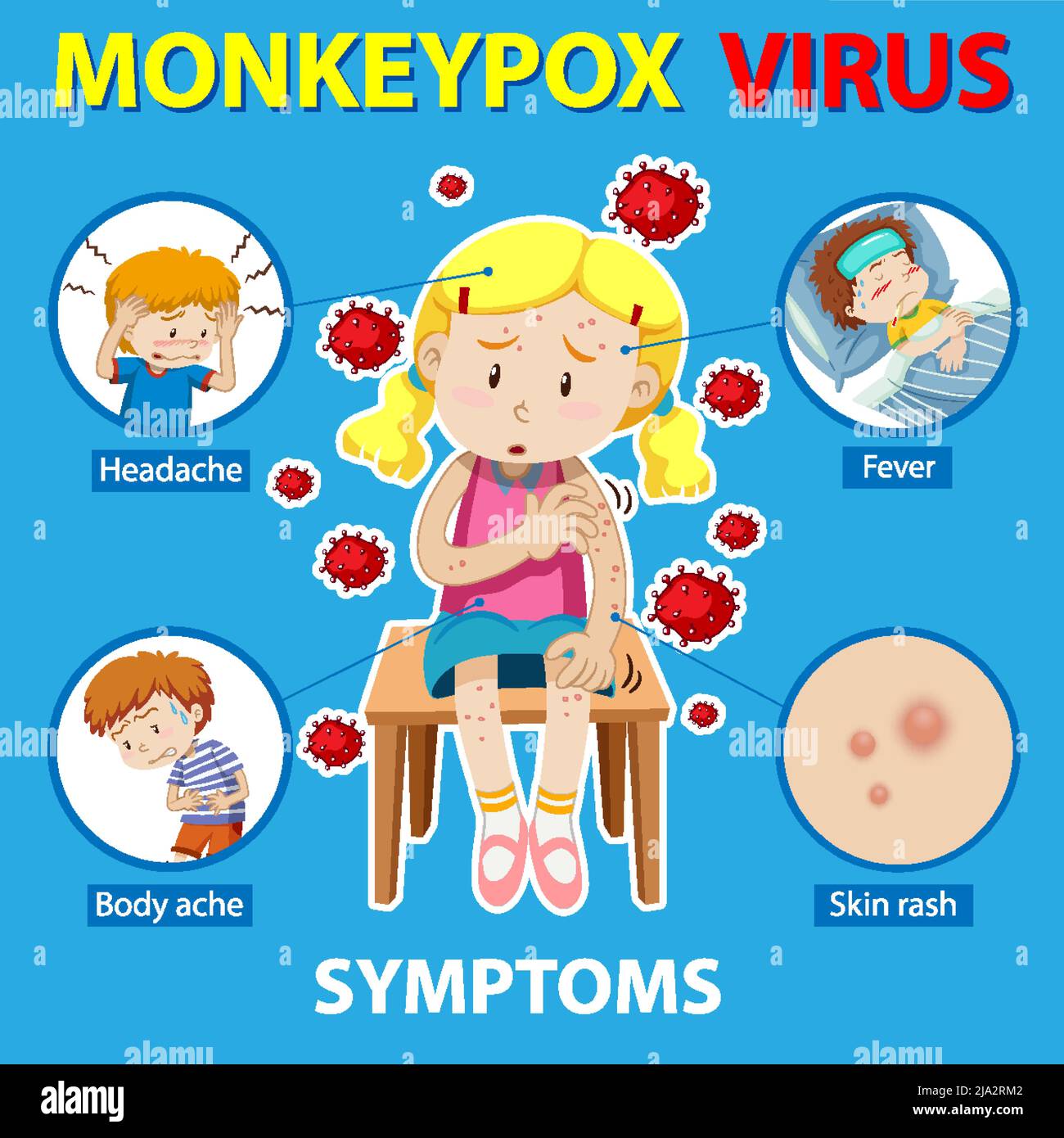 A girl with monkeypox and the symptoms illustration Stock Vector Image ...