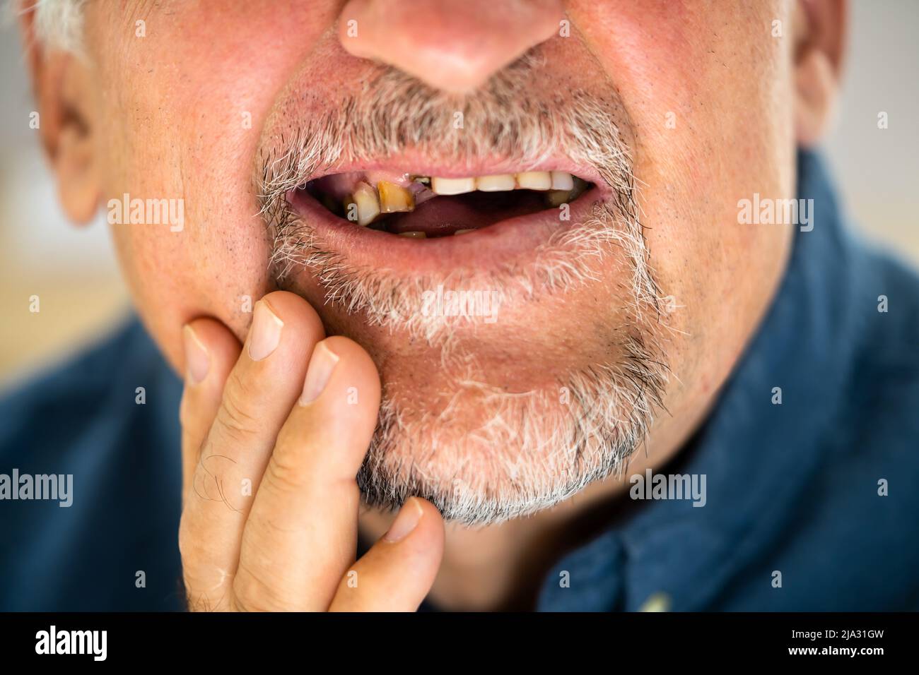 Close up man touching mouth hi-res stock photography and images - Alamy