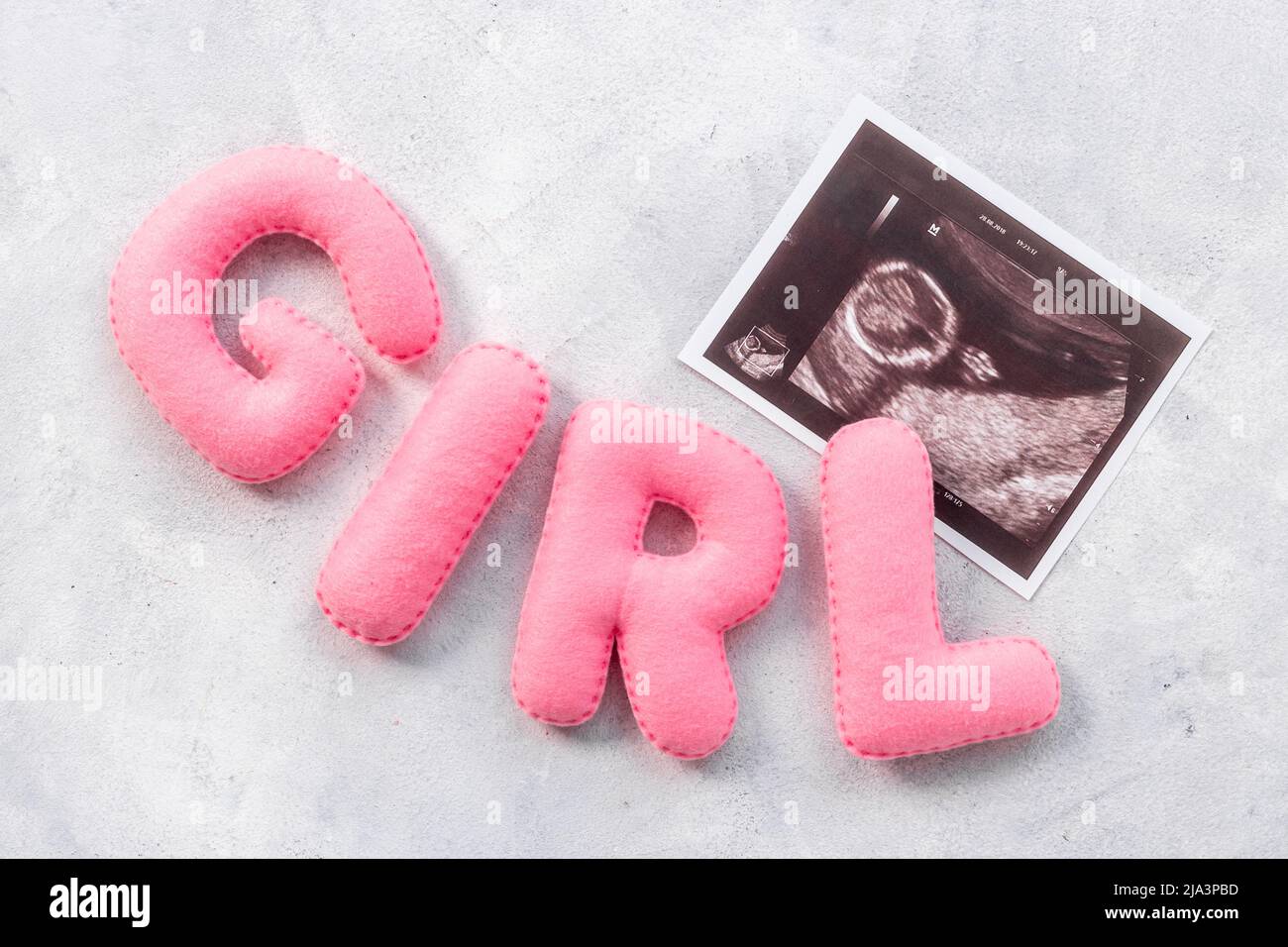 Ultrasound scan of unborn baby with letters girl Stock Photo - Alamy