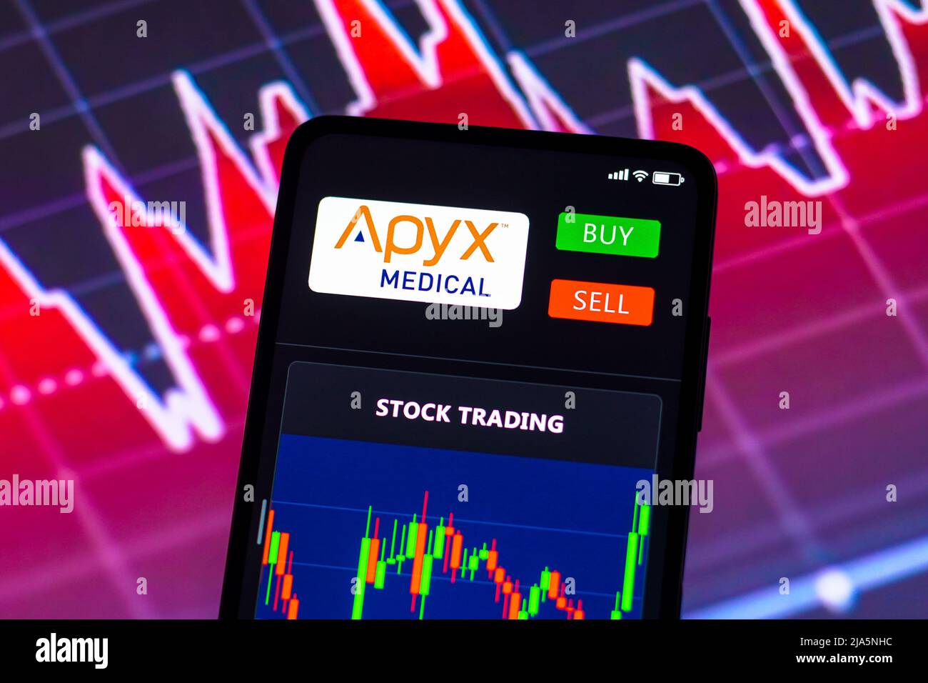 In this photo illustration the stock trading graph of Apyx Medical seen ...