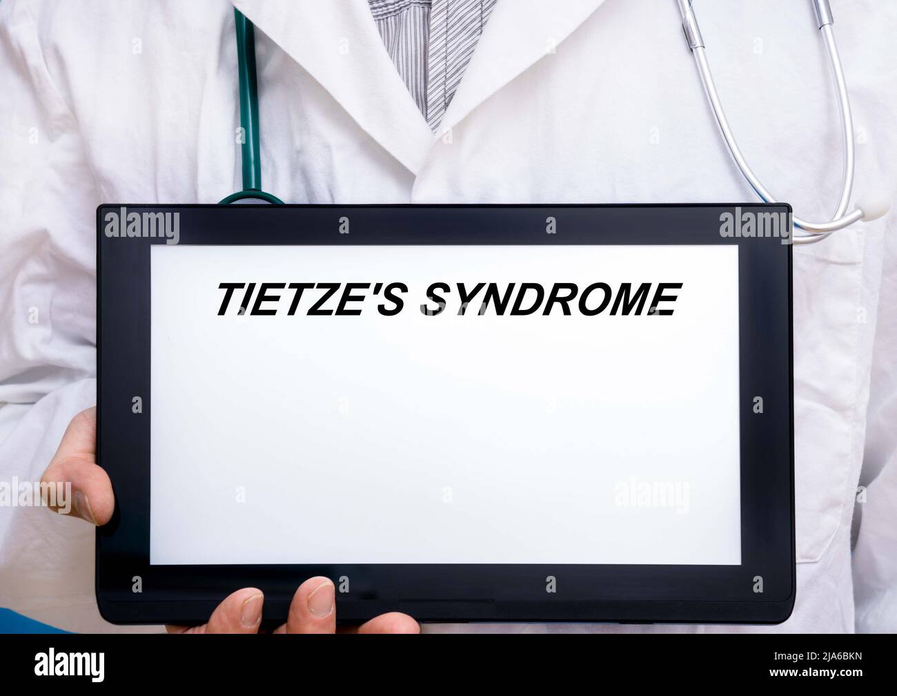 Tietzes syndrome disease hi-res stock photography and images - Alamy