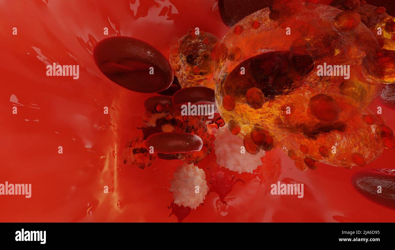 Monkeypox infection pandemic. monkeypox cell, symptoms or precautions ...