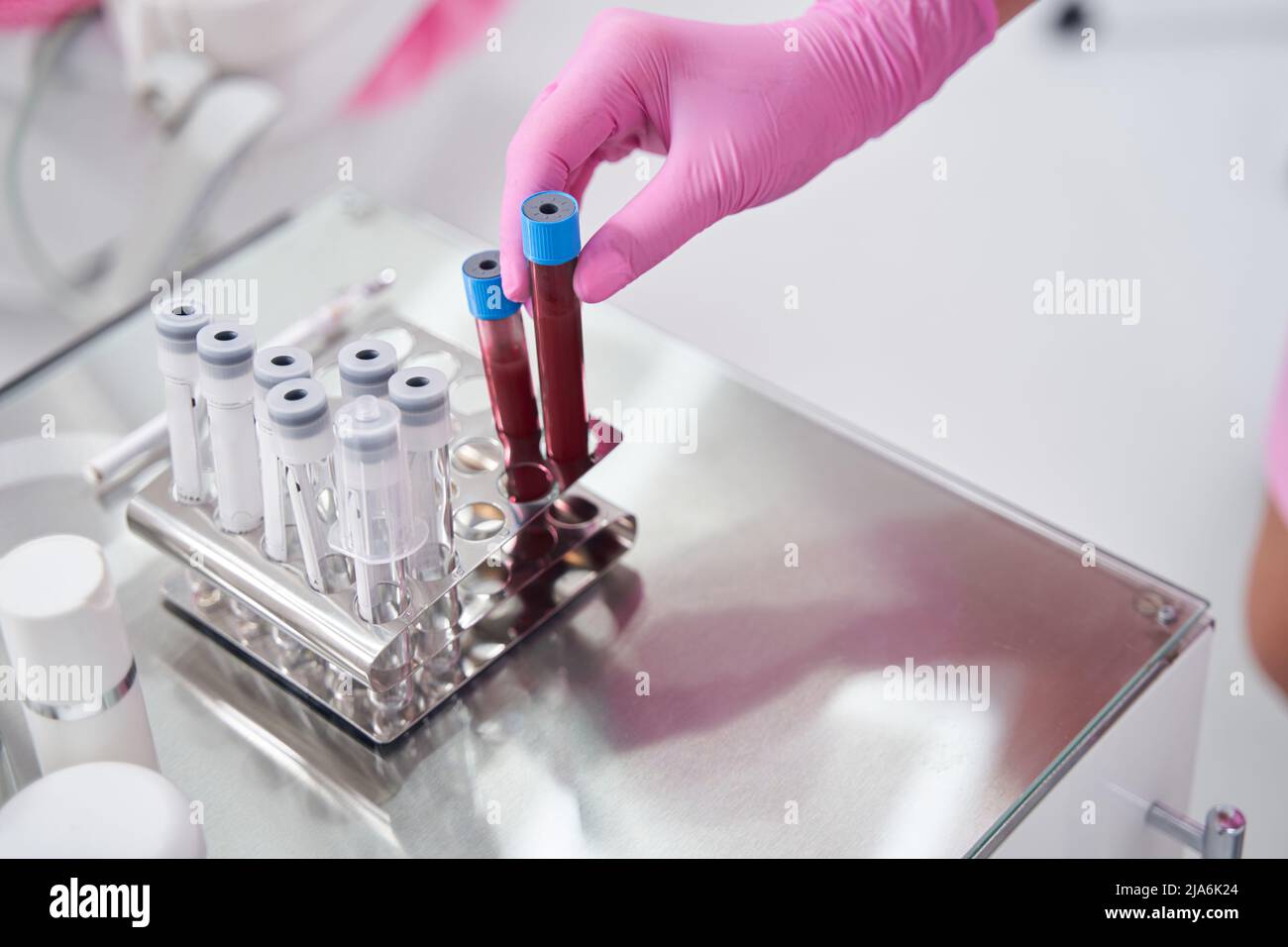 Two blood-filled test tubes are placed in special rack Stock Photo - Alamy