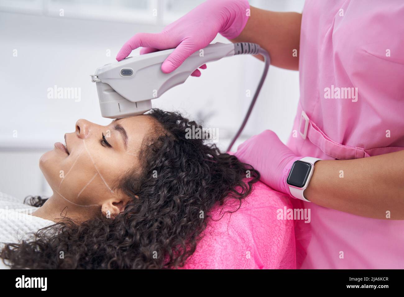 SMAS lifting procedure on the upper face of a lady Stock Photo - Alamy