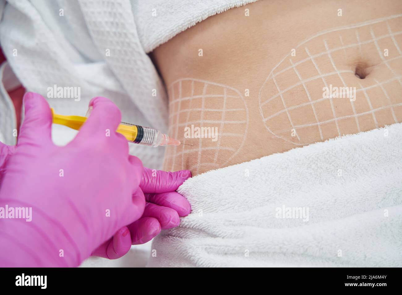 Dermatologist performing non invasive fat reduction procedure in beauty ...