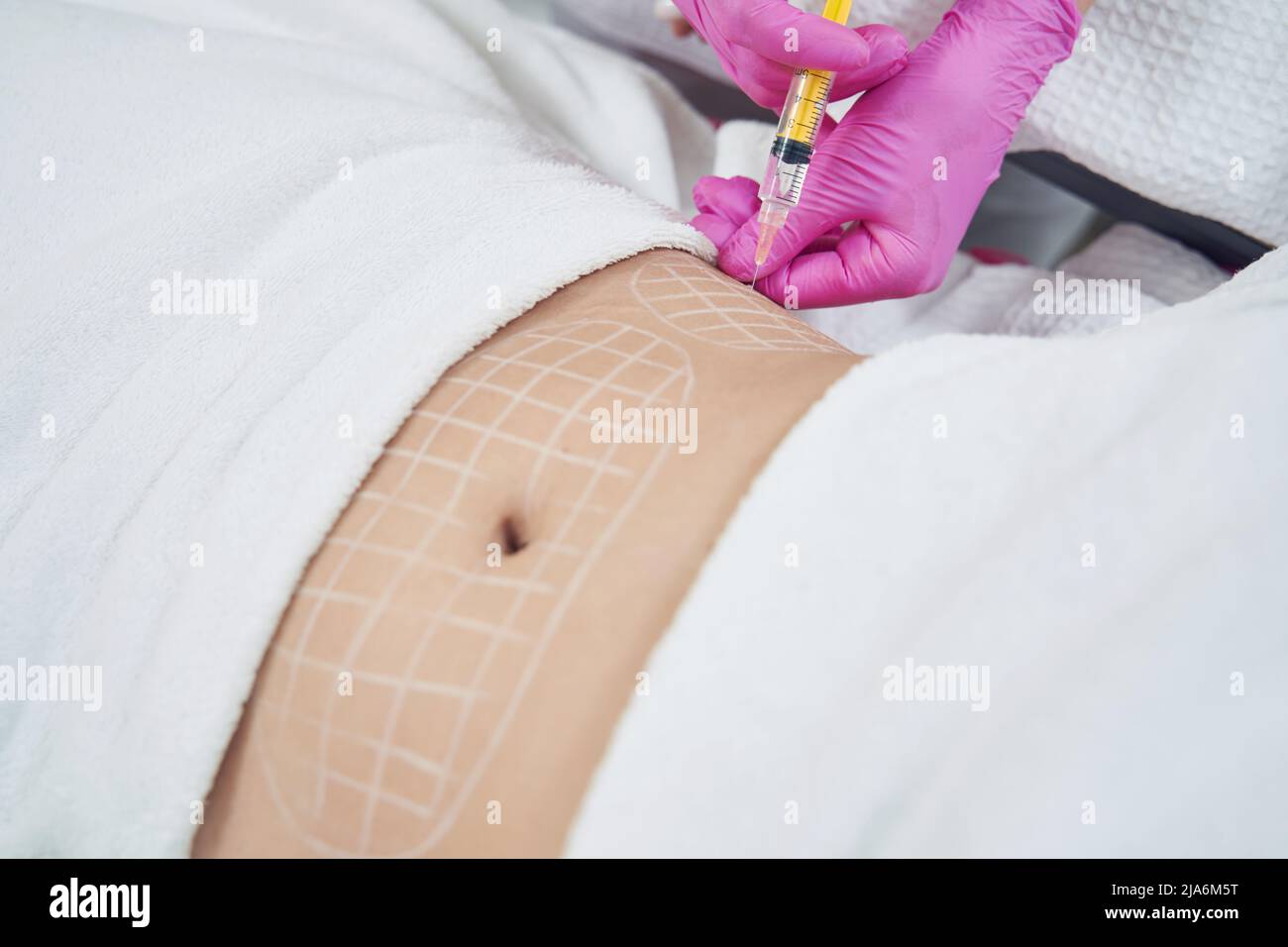 Client is receiving slimming body contouring procedure in aesthetic ...