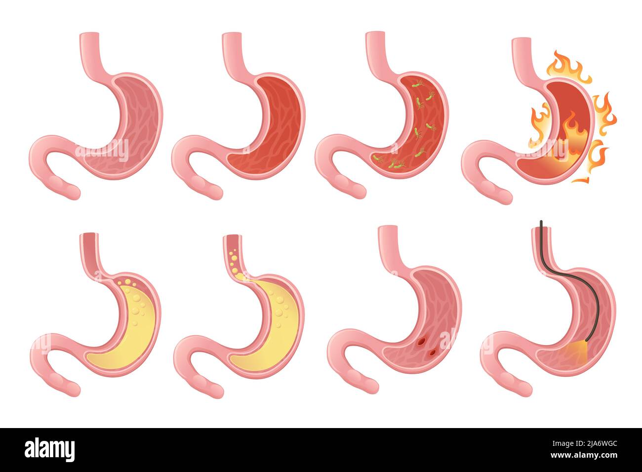 Set of Human Stomach cartoon design human anatomy organ vector ...