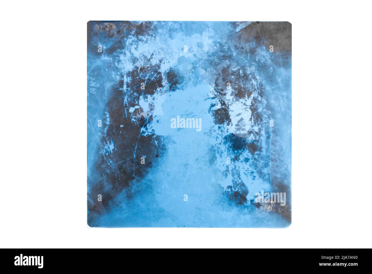 Old, used x-ray image scratched and dirty medical object Stock Photo ...