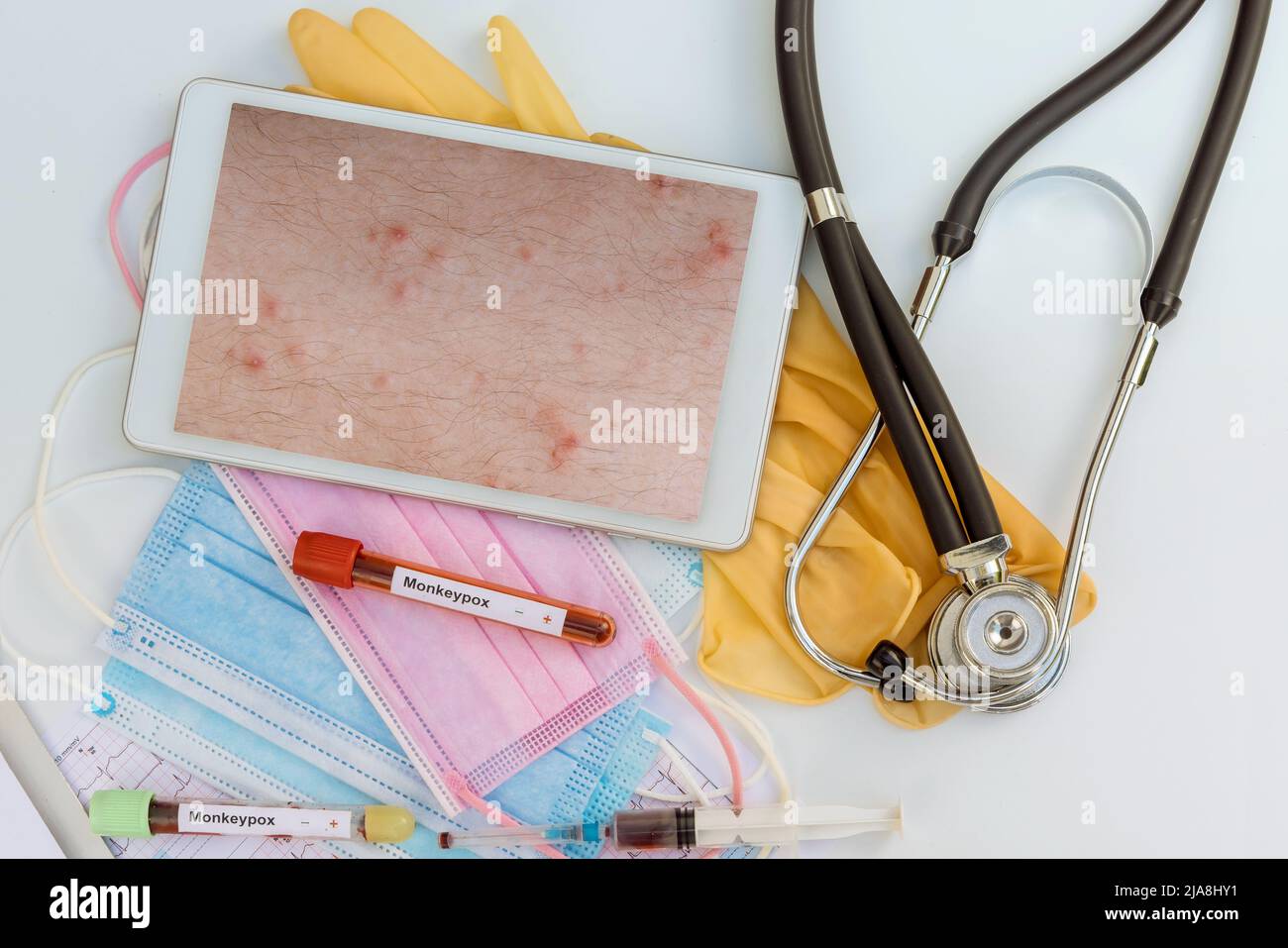 Skin rash and fever hi-res stock photography and images - Alamy