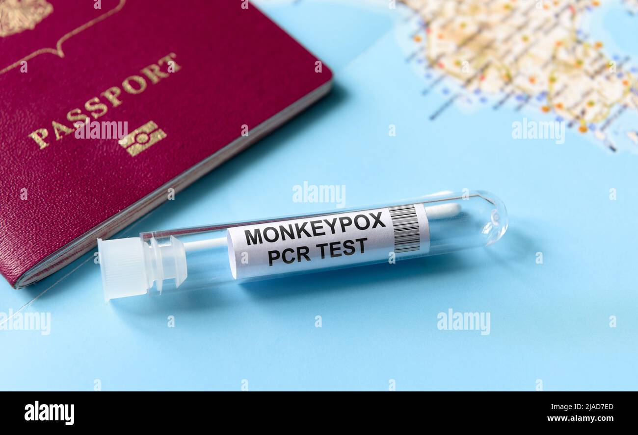 Monkeypox, travel and test concept, tube for PCR testing and tourist ...