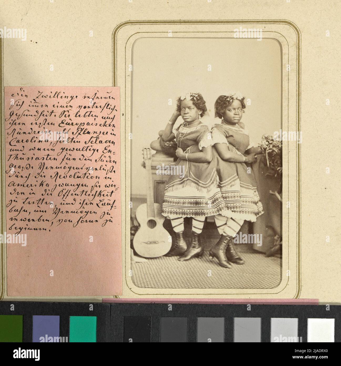 The Siamese twins Millie and Christine McKoy, "The Two Headed ...