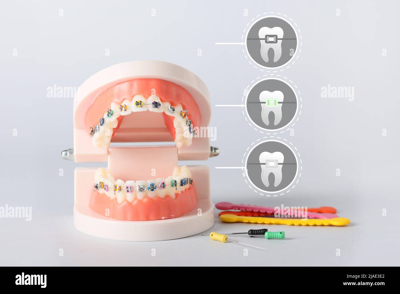 Model of jaw with braces and dental tools on light background Stock ...