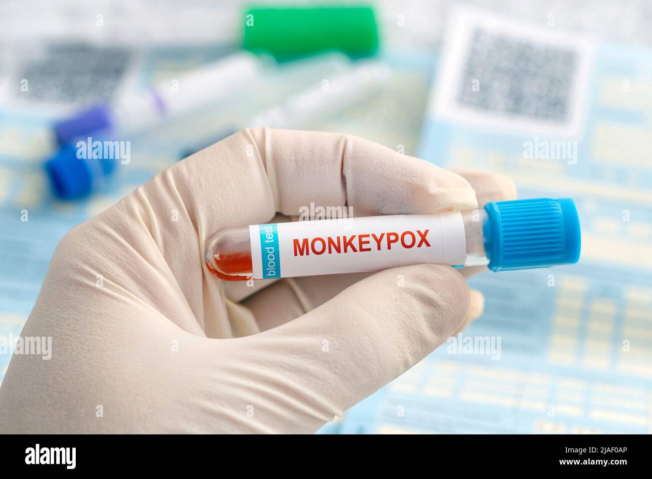 Monkeypox pcr test hi-res stock photography and images - Alamy