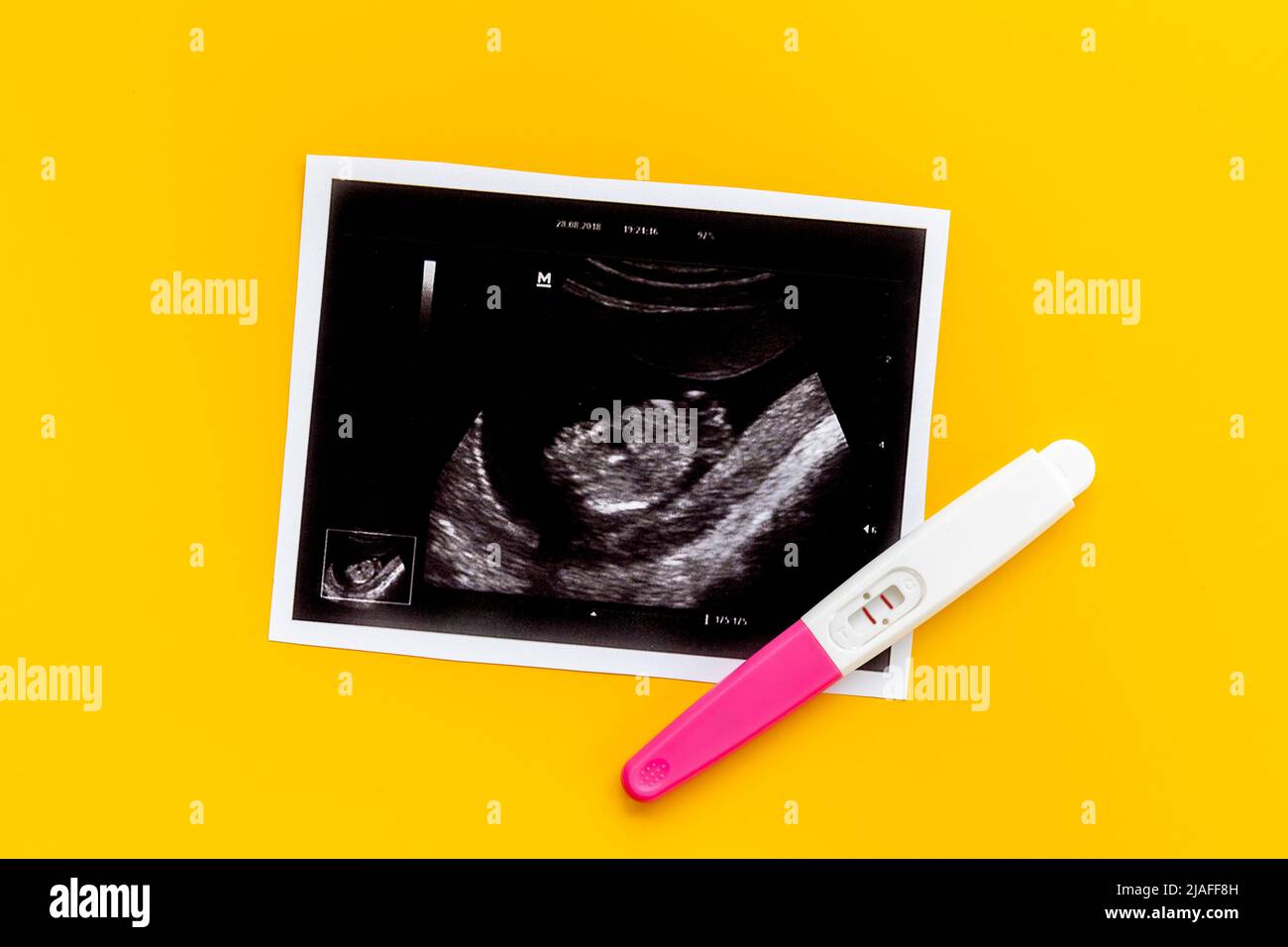 Baby and parent screening hi-res stock photography and images - Alamy