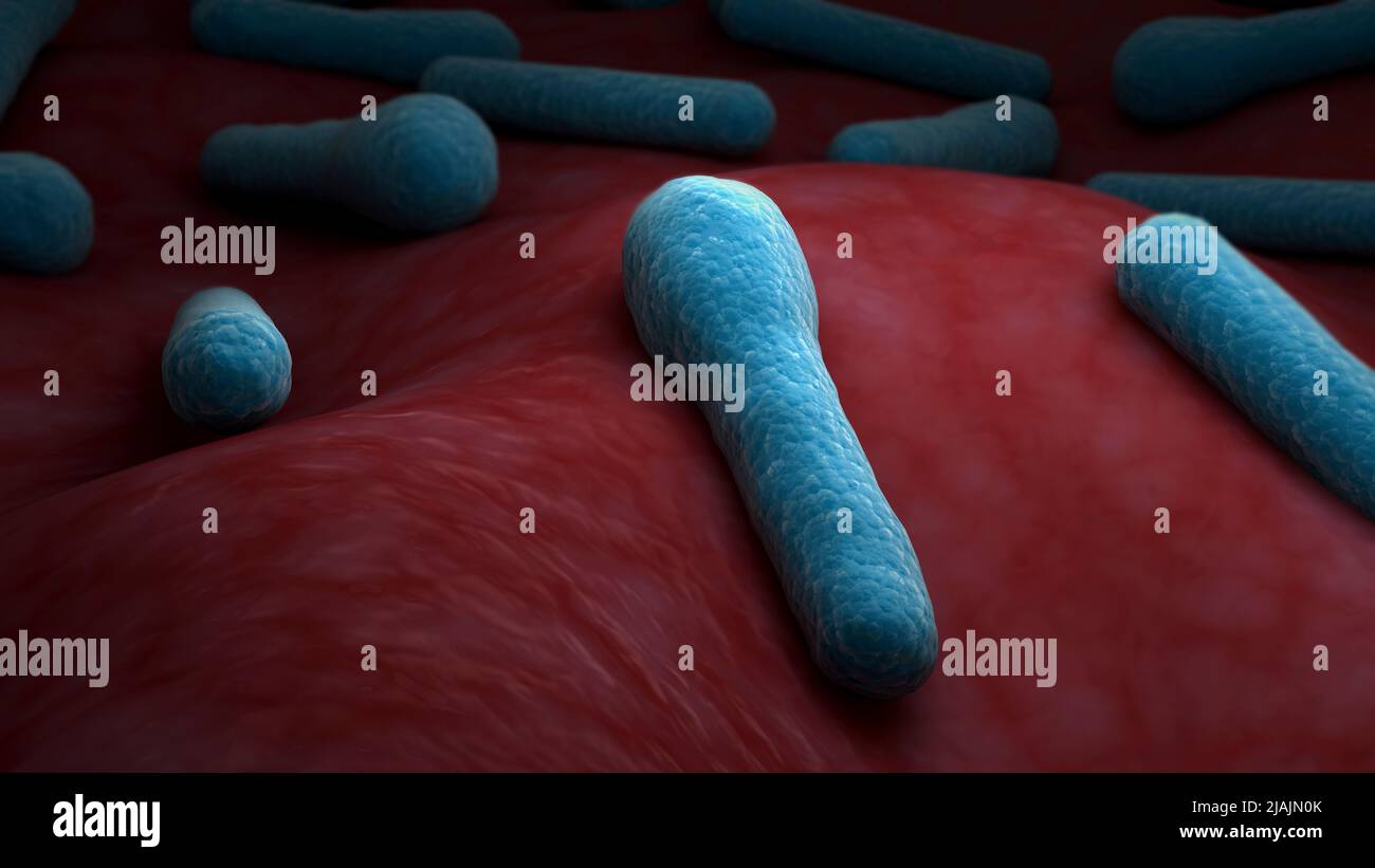 Botulism hi-res stock photography and images - Alamy