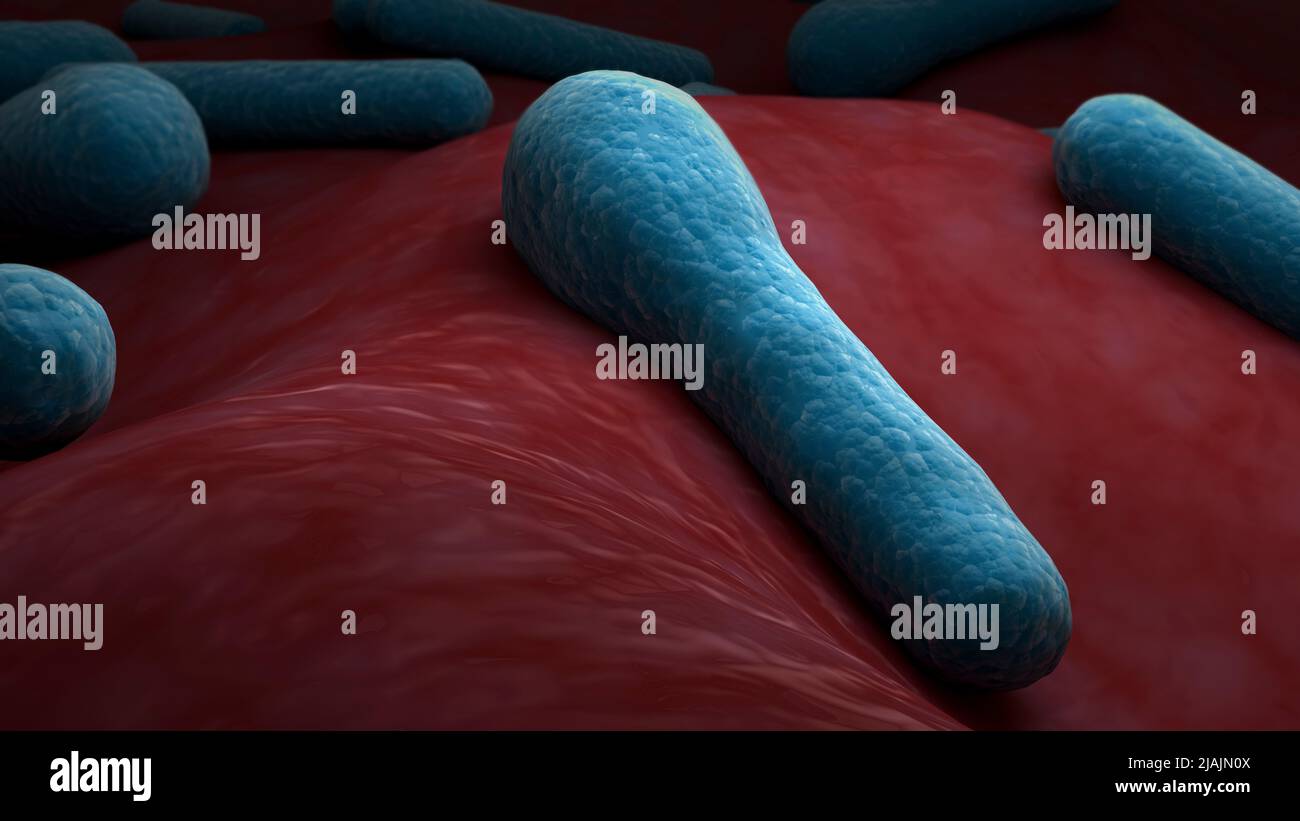 Botulism hi-res stock photography and images - Alamy