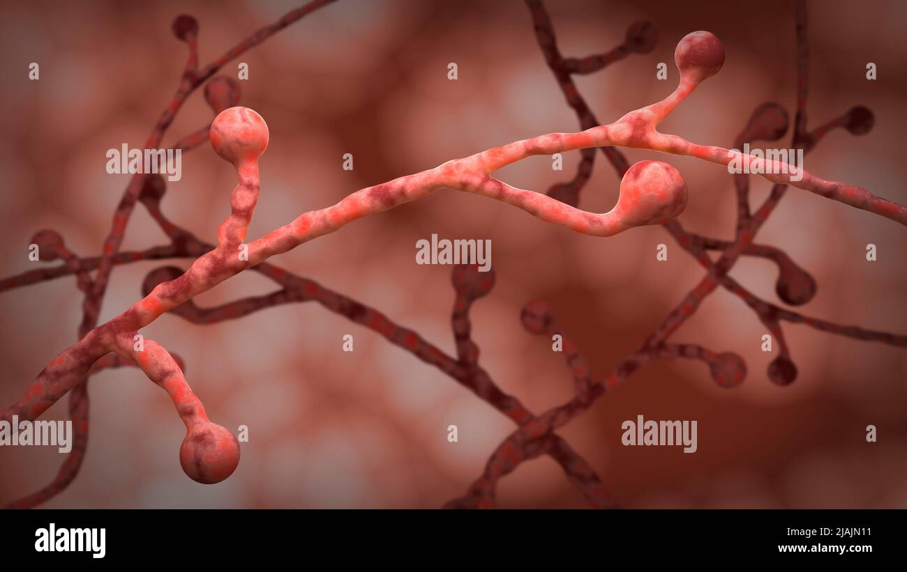 Conceptual biomedical illustration of blastomycosis fungal infection ...