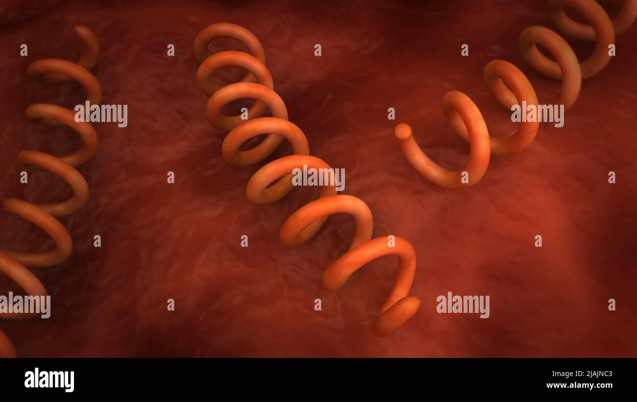 Conceptual biomedical illustration of Treponema pallidum bacteria Stock ...