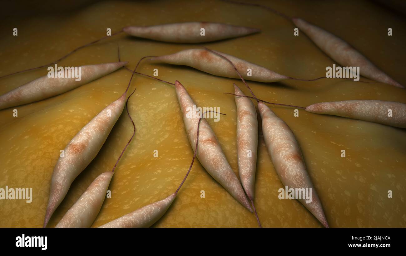 Visceral leishmaniasis disease hi-res stock photography and images - Alamy