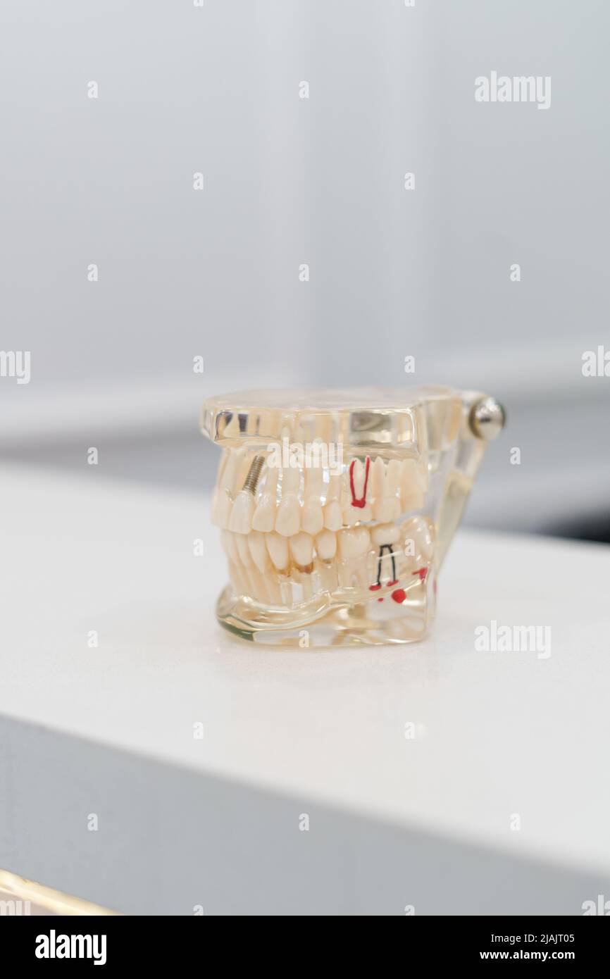 modern glass denture, didactic article for teaching, details of teeth ...