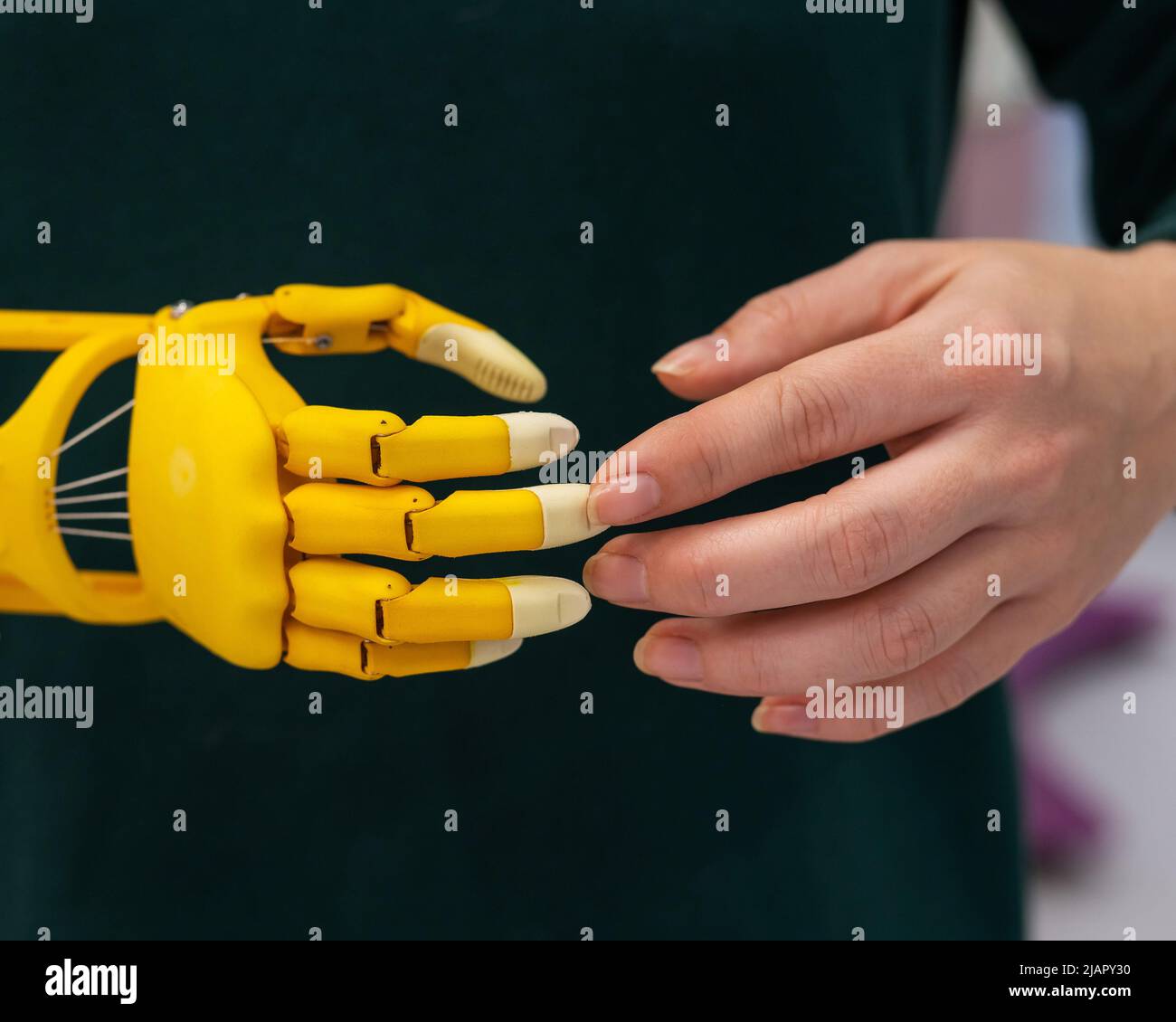 A woman demonstrates a plastic children's prosthetic hand printed on a ...