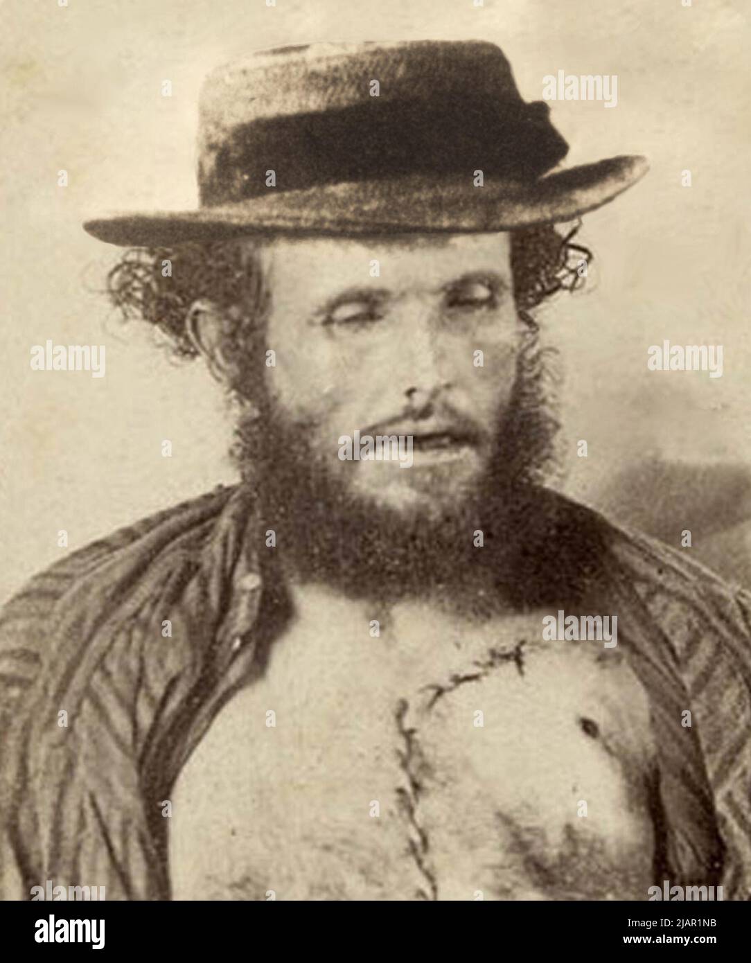 Fred Ward (alias Captain Thunderbolt) Australian bushranger after being ...