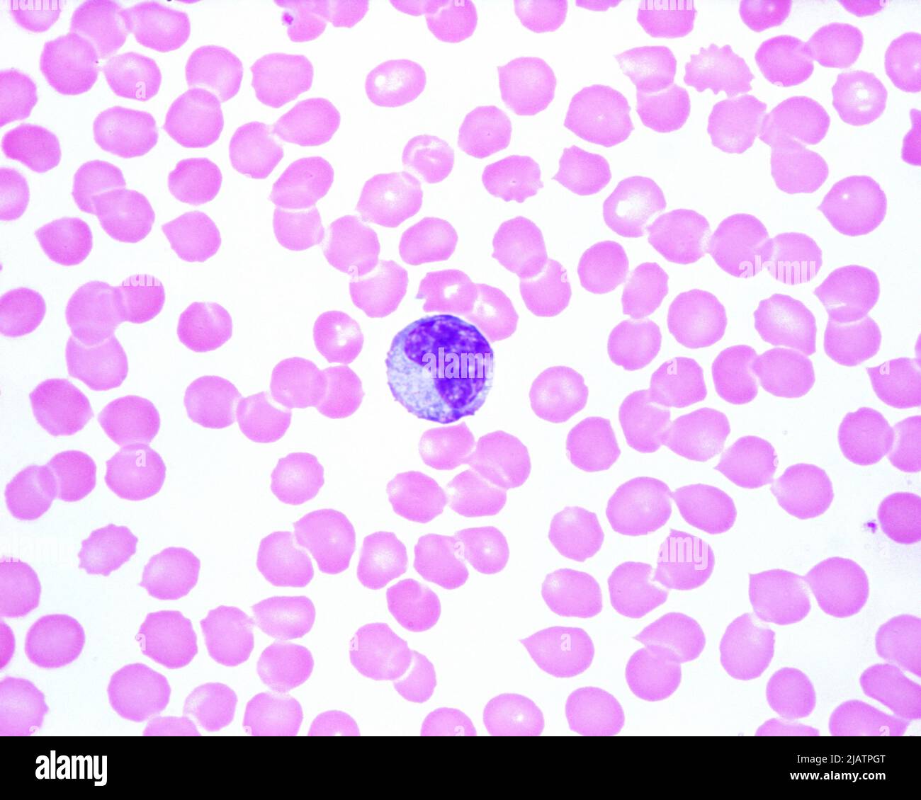 Human blood smear with monocyte, light micrograph Stock Photo - Alamy