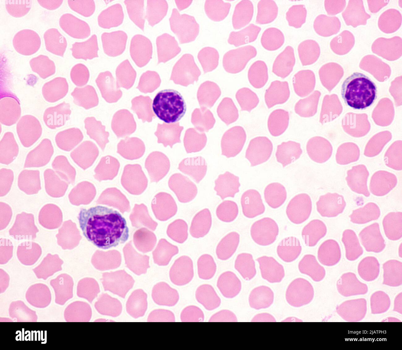 Human blood smear, light micrograph Stock Photo - Alamy