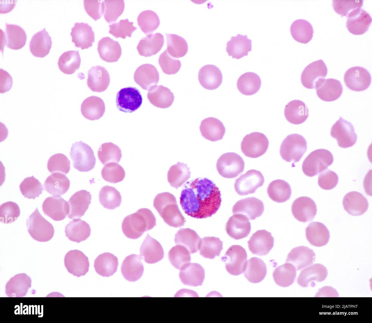 Human blood smear, light micrograph Stock Photo - Alamy