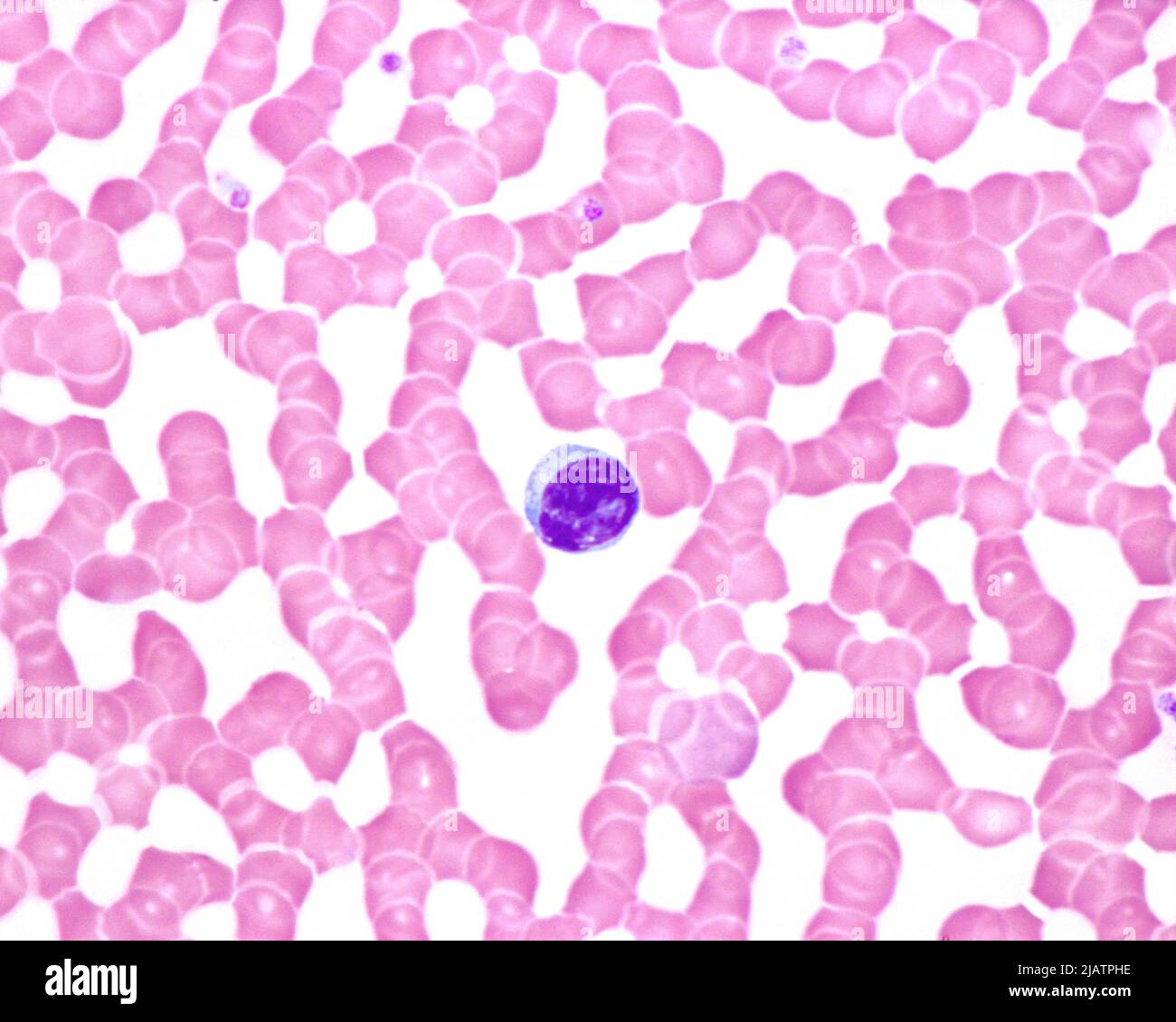 Human blood smear with lymphocyte, light micrograph Stock Photo - Alamy
