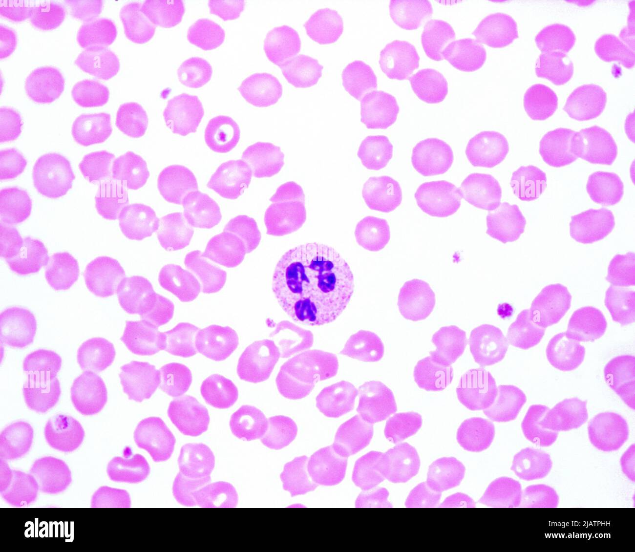 Human blood smear with neutrophil, light micrograph Stock Photo - Alamy