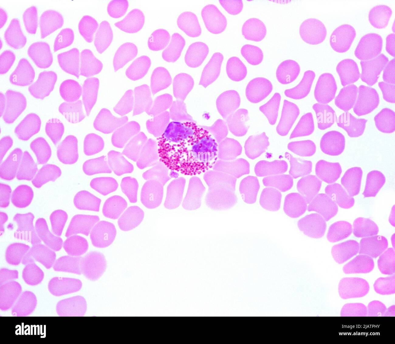 Human blood smear with eosinophil, light micrograph Stock Photo - Alamy