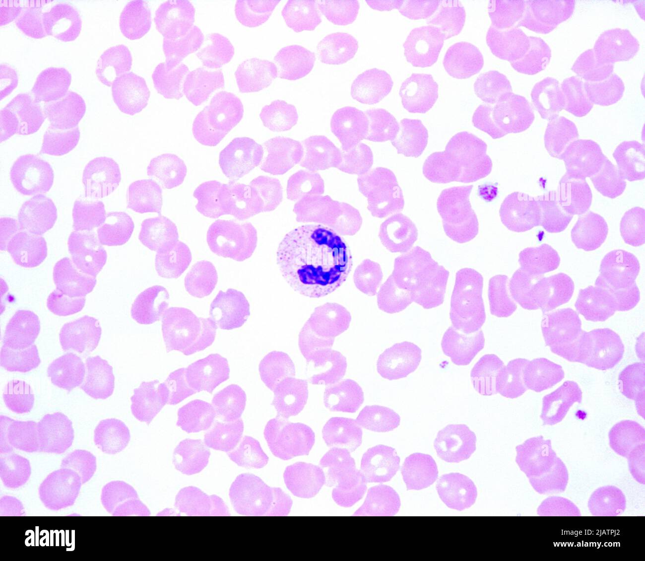 Human blood smear, light micrograph Stock Photo - Alamy