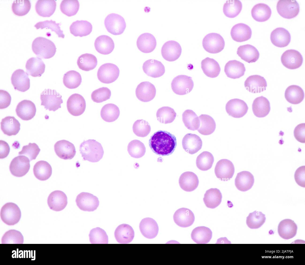 Human blood smear with lymphocyte, light micrograph Stock Photo - Alamy