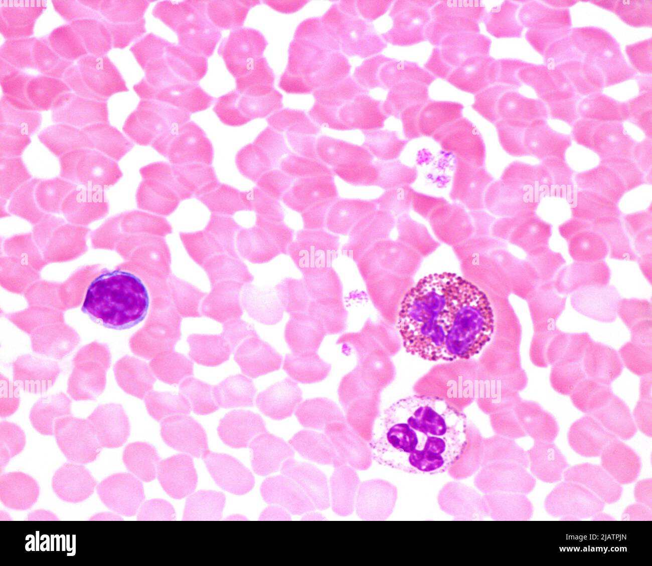 Human blood smear with leukocytes, light micrograph Stock Photo - Alamy Human blood smear with leukocytes, light micrograph Stock Photo - Alamy